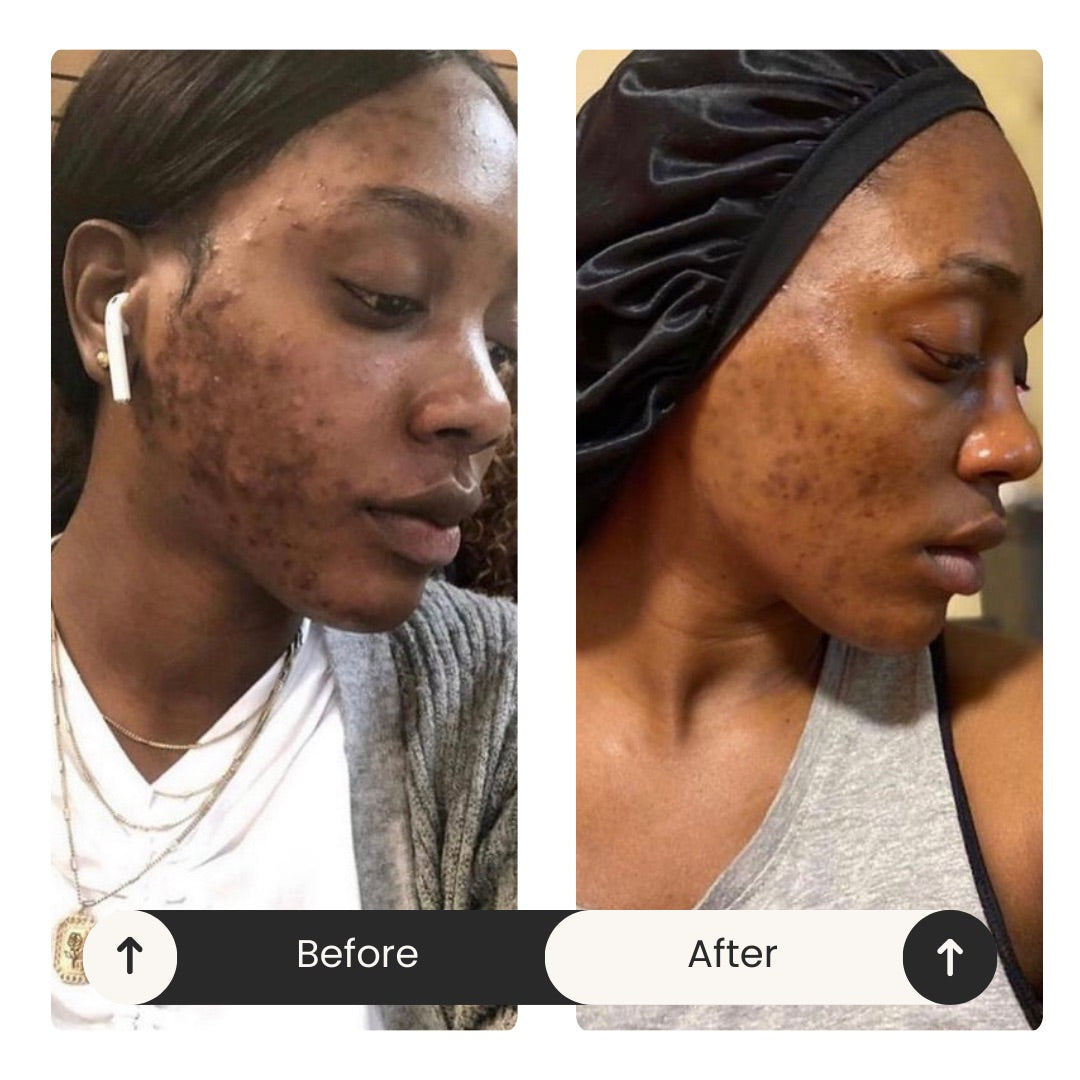 NN BODY | FOR EVERY WOMAN